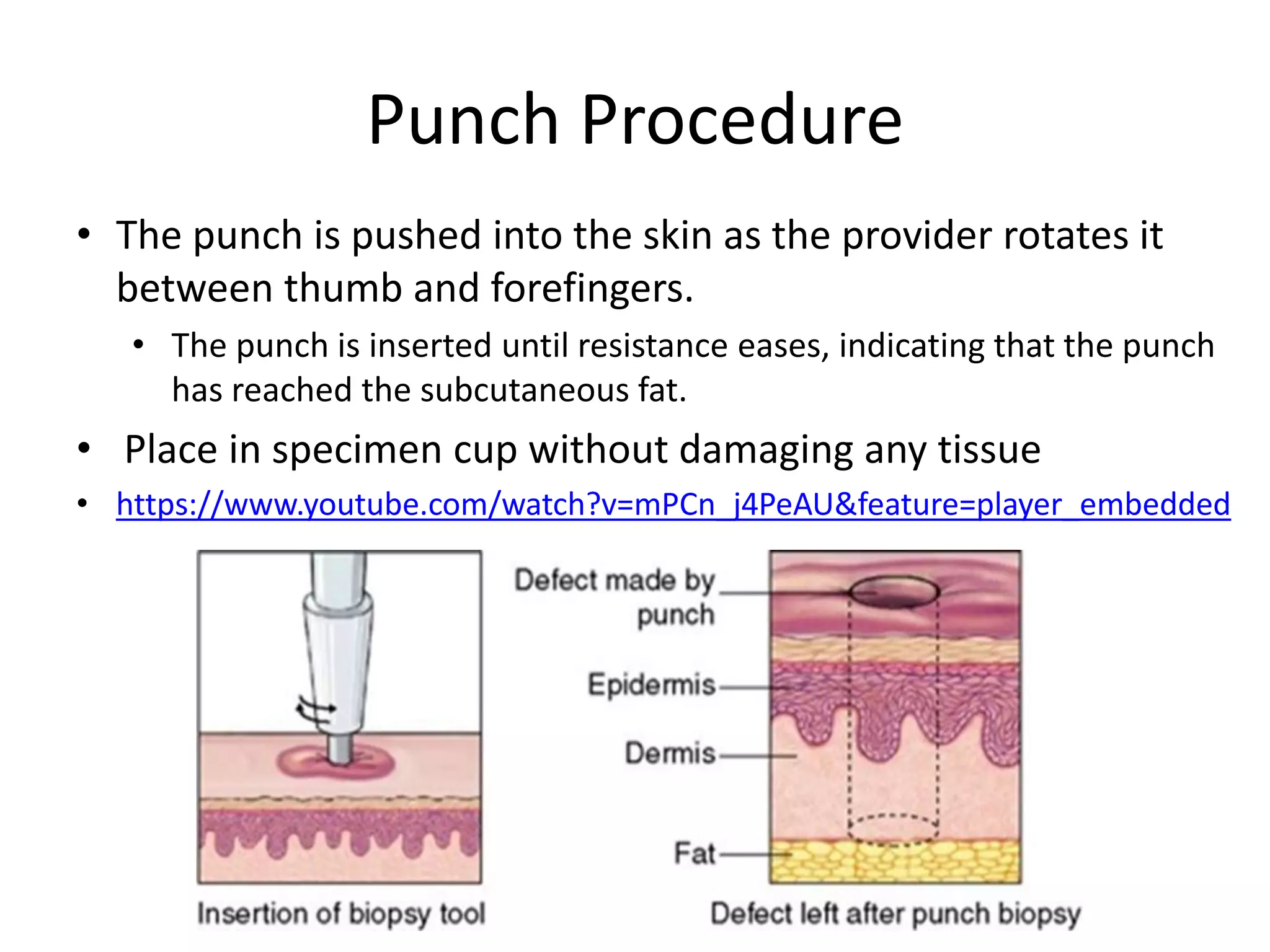 Skin Tag Removal and Skin Biopsies.pptx