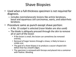 Skin Tag Removal and Skin Biopsies.pptx