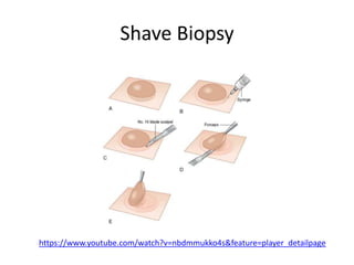 Skin Tag Removal and Skin Biopsies.pptx