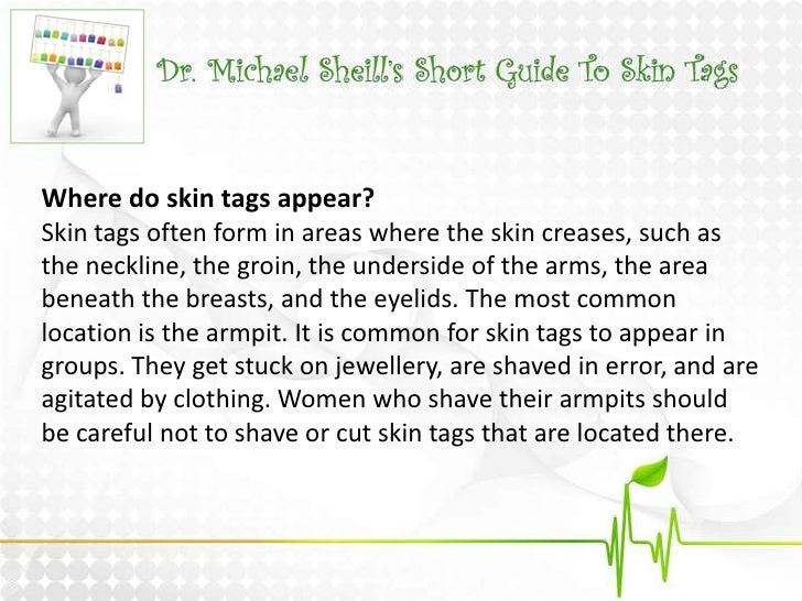 Dr. Michael Sheill's Short Guide To Skin Tags