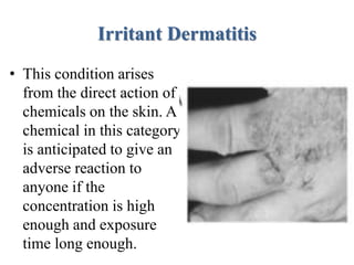 Skin toxicology | PPTX | Skin and Dermatology | Diseases and Conditions