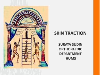 skin traction.pptx