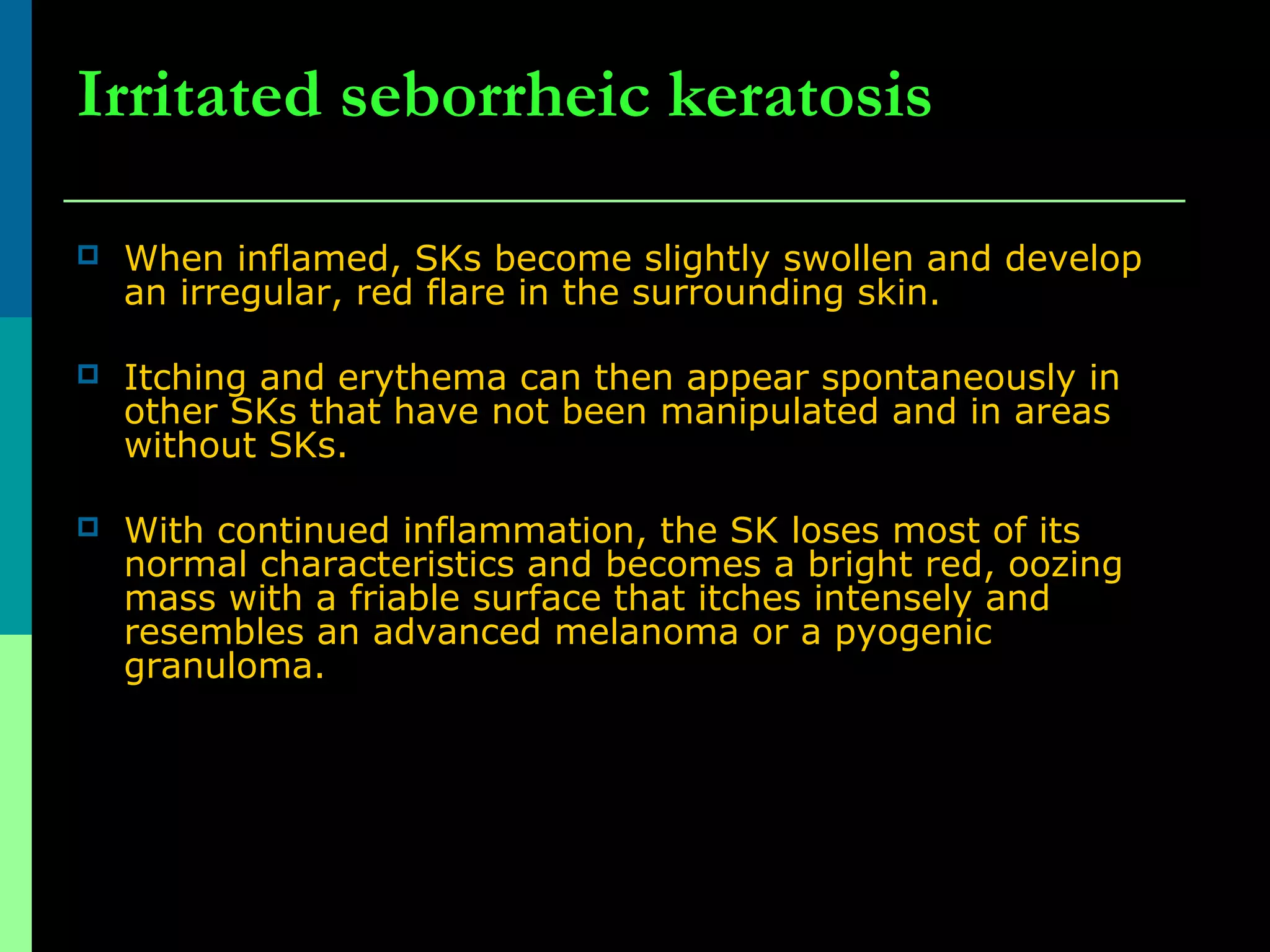 Benign and Malignant Skin Leisions | PPT
