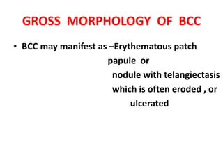 Pathology of skin tumors in detail 12.pptx