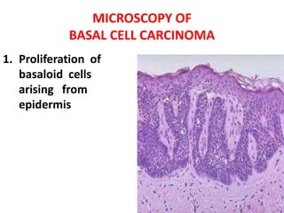 Pathology of skin tumors in detail 12.pptx