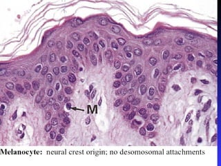 SKIN TUMORS SCC BCC melanoma pathological aspect- gross and microscopy ...