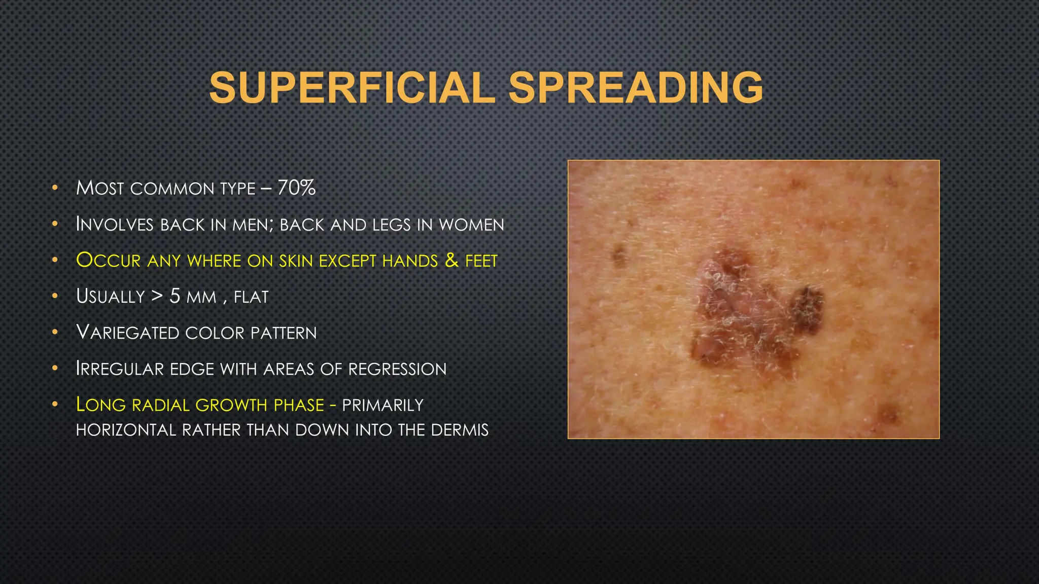 skin tumours ppt dept of surgical oncology | PDF