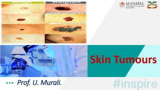 Skin Tumors - Benign And Malignant Tumors | PDF