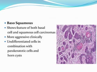 Skin tumours pathology | PPTX