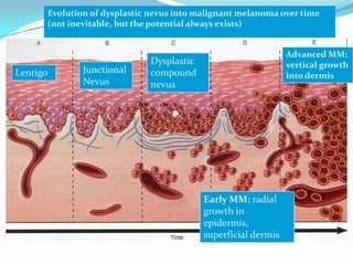 Skin tumours pathology | PPTX