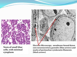 Skin tumours pathology | PPTX
