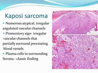 Skin tumours pathology | PPTX