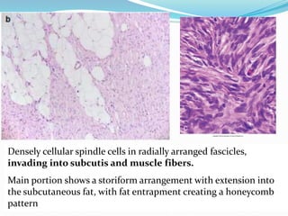 Skin tumours pathology | PPTX