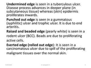 SKIN ULCERS.pptx