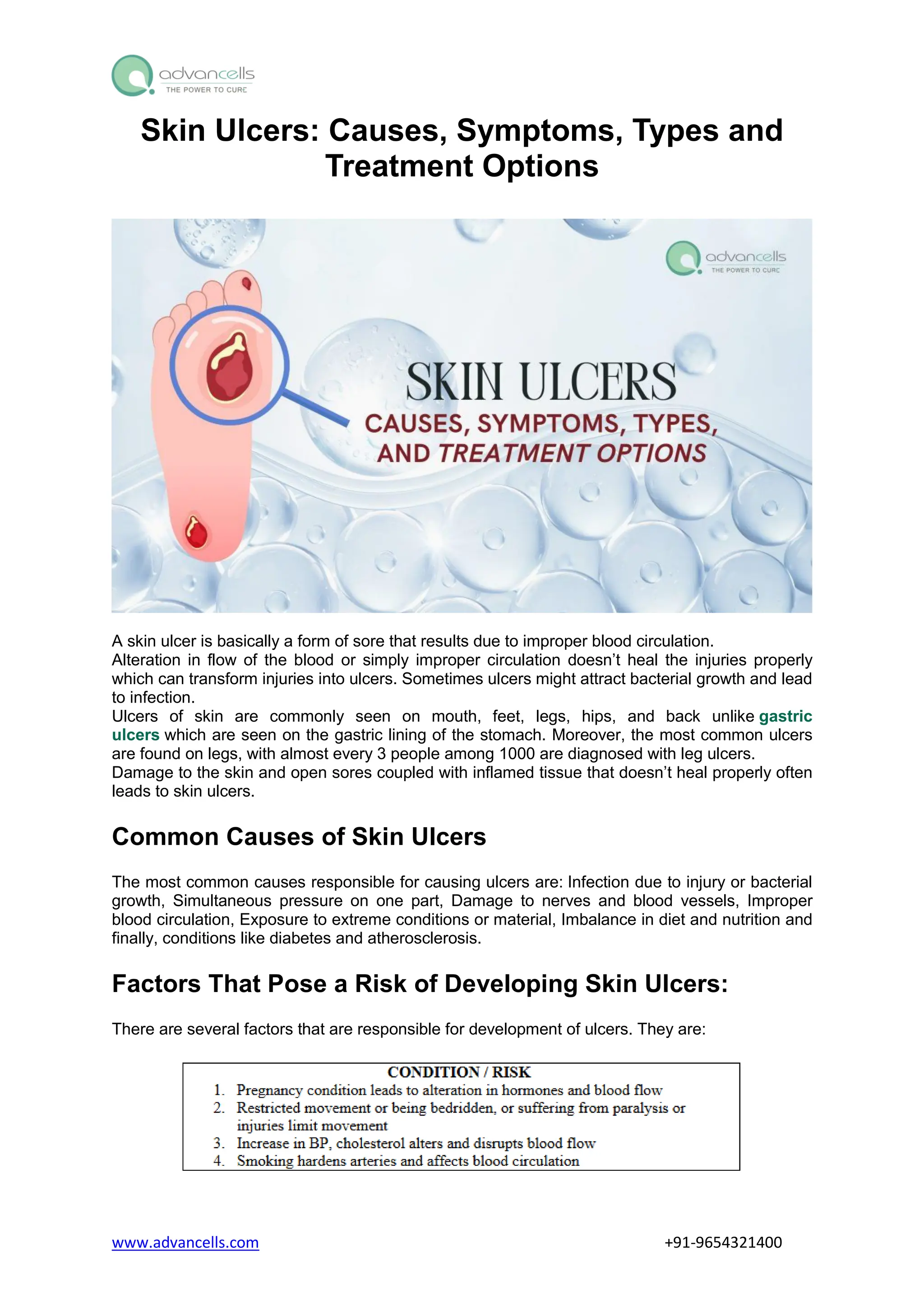 Skin Ulcers: Causes, Symptoms, Types and Treatment Options | PDF