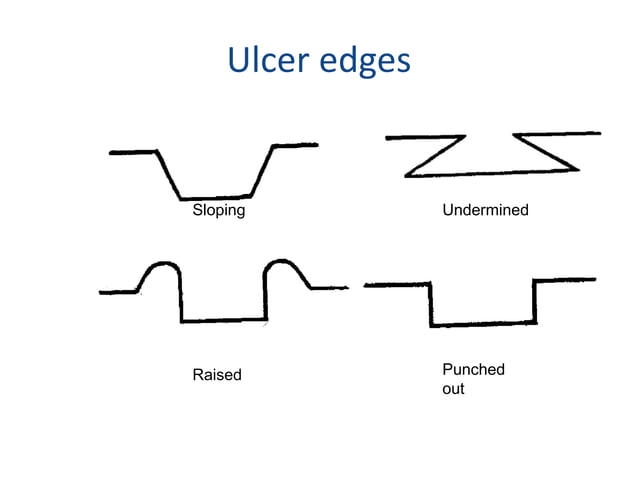 Skin Ulcers Overview ppt | PPTX | Skin and Dermatology | Diseases and ...