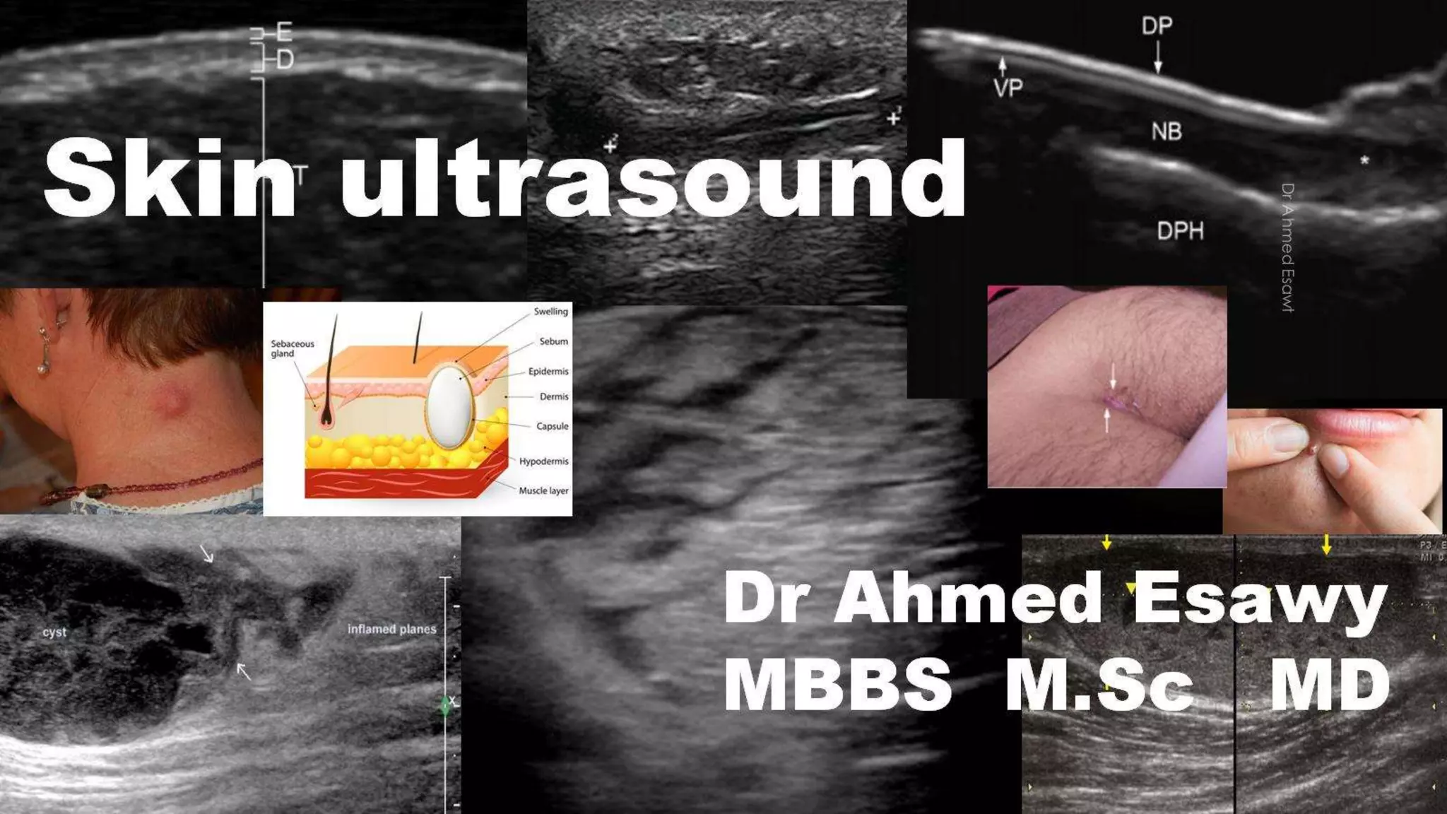 Skin ultrasound | PPTX