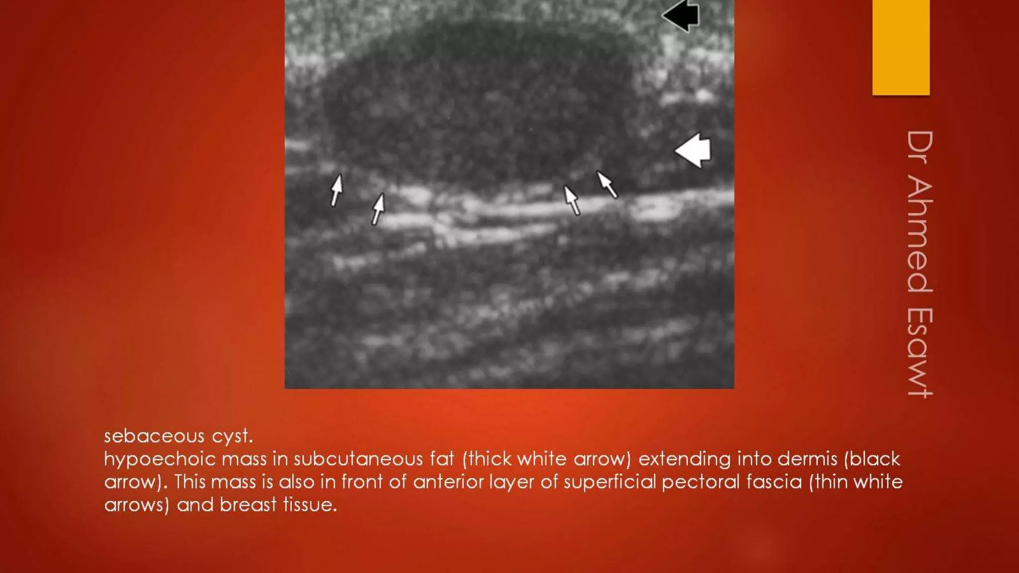 Skin ultrasound | PPTX
