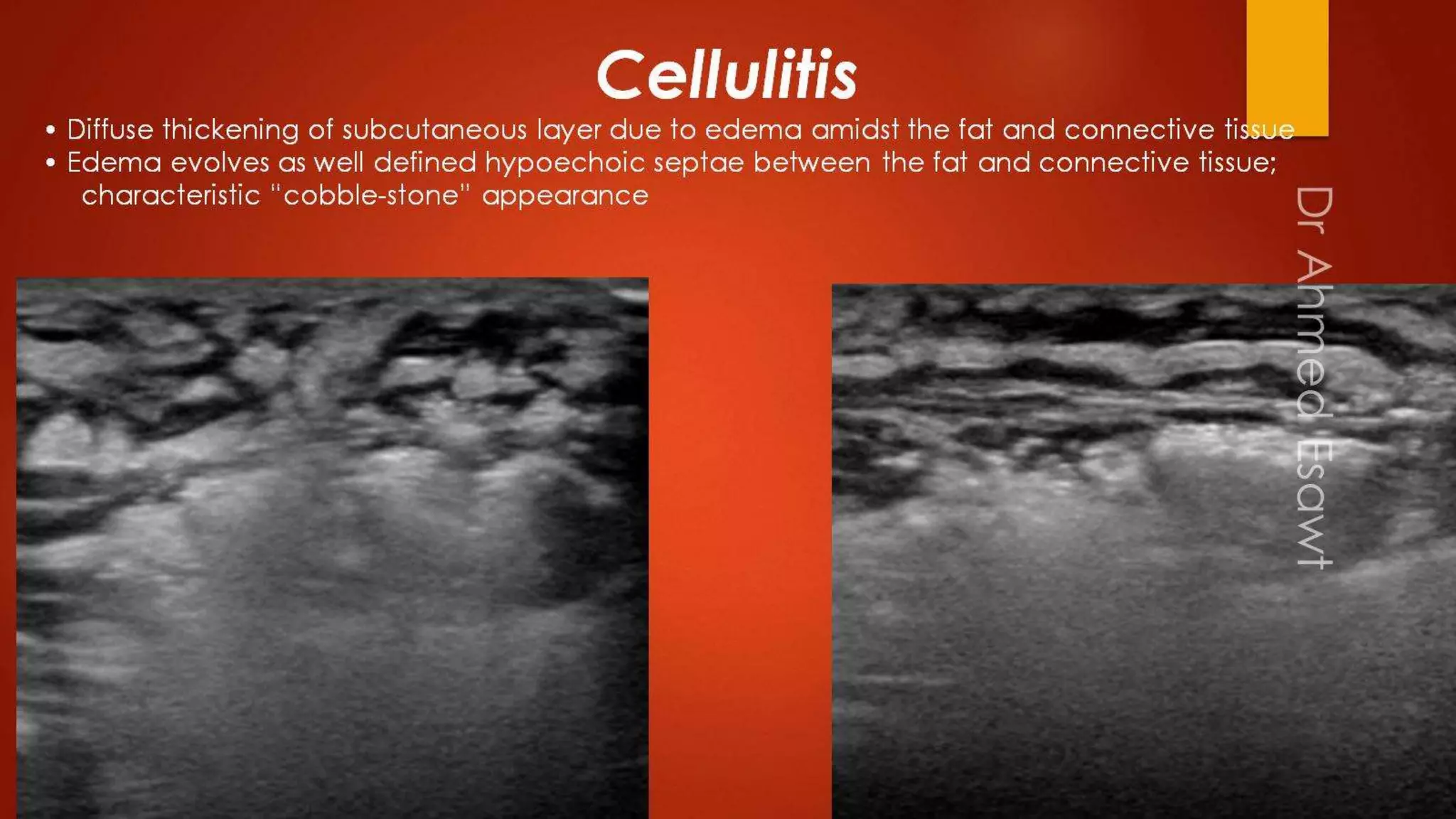 Skin ultrasound | PPTX