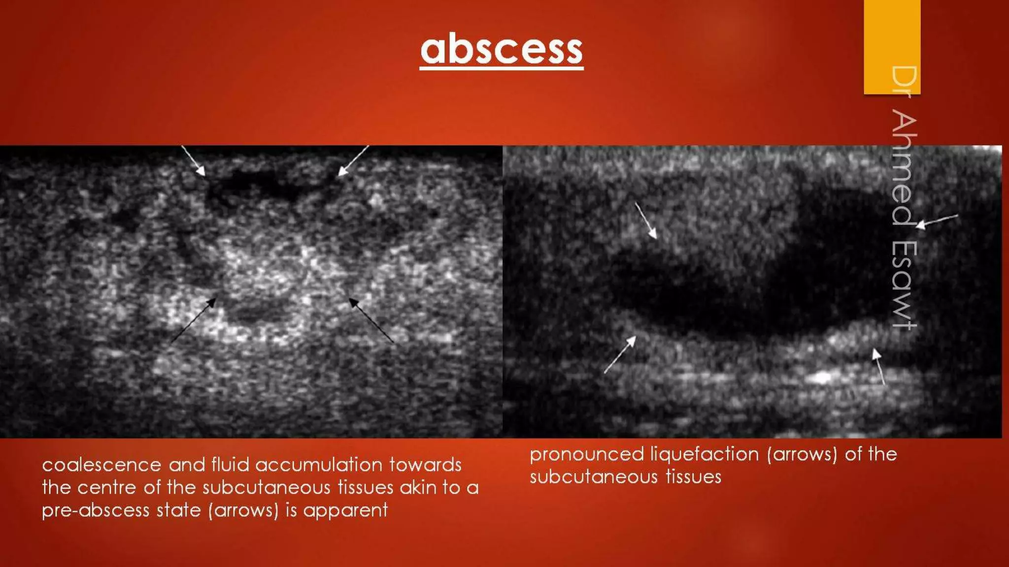 Skin ultrasound | PPTX