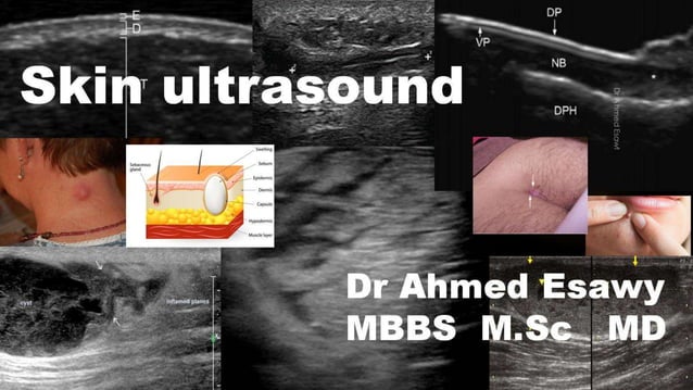 Skin ultrasound | PPT