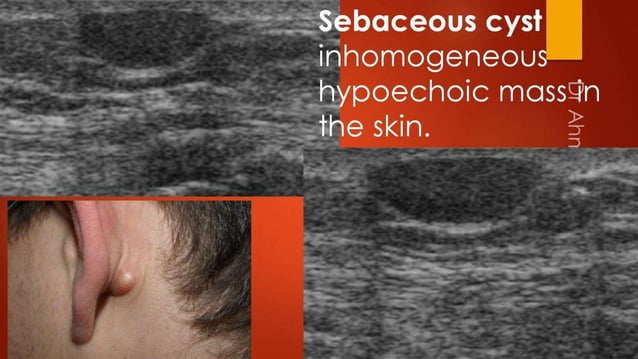 Skin ultrasound | PPT