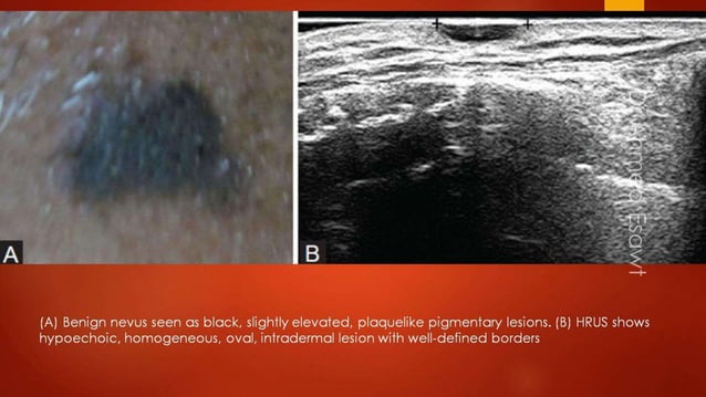 Skin ultrasound | PPT