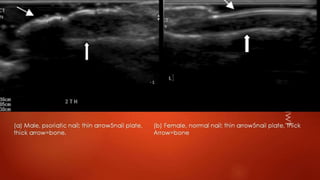 Skin ultrasound | PPTX