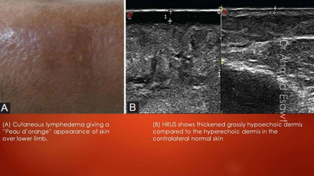 Skin ultrasound | PPT