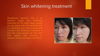 Skin whitening treatments | PPTX