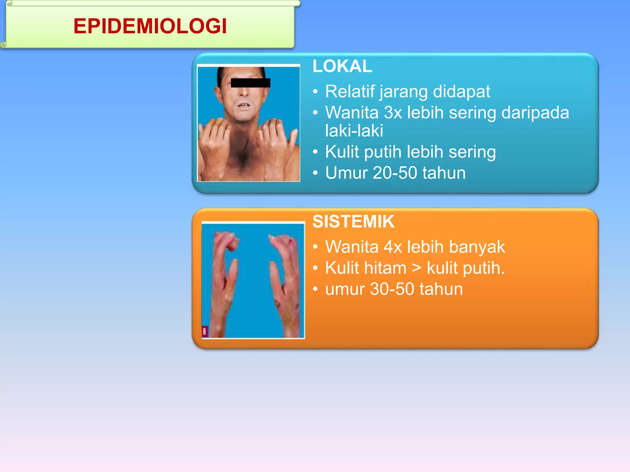 Skleroderma ppt | PPTX