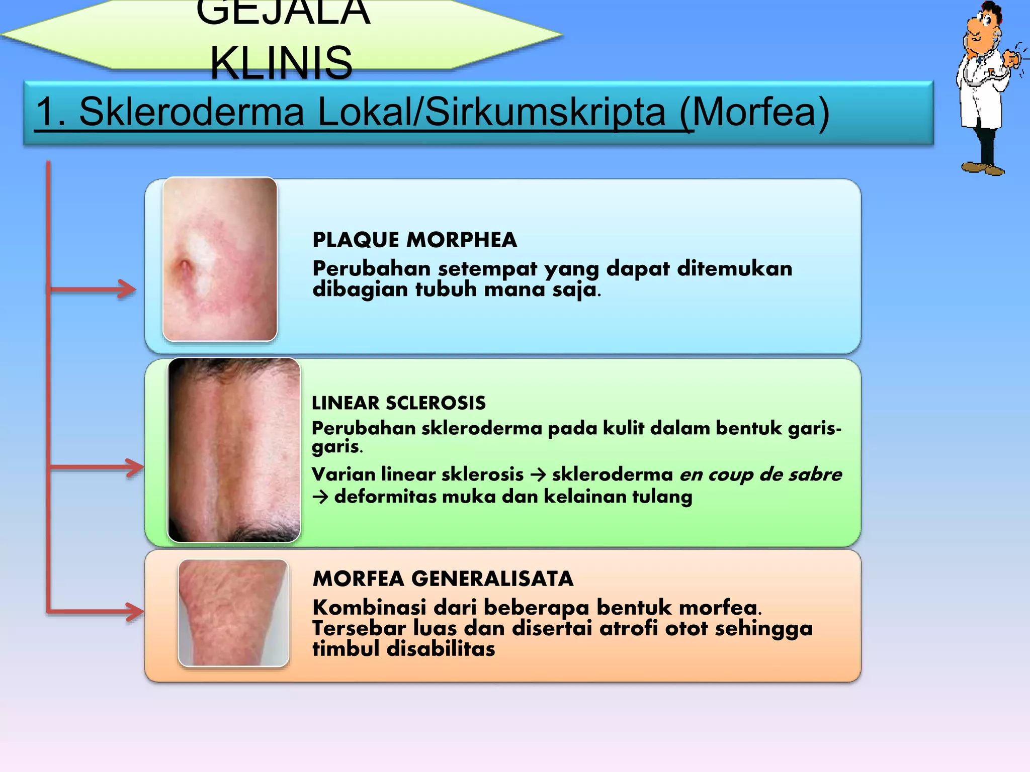 Skleroderma ppt | PPTX