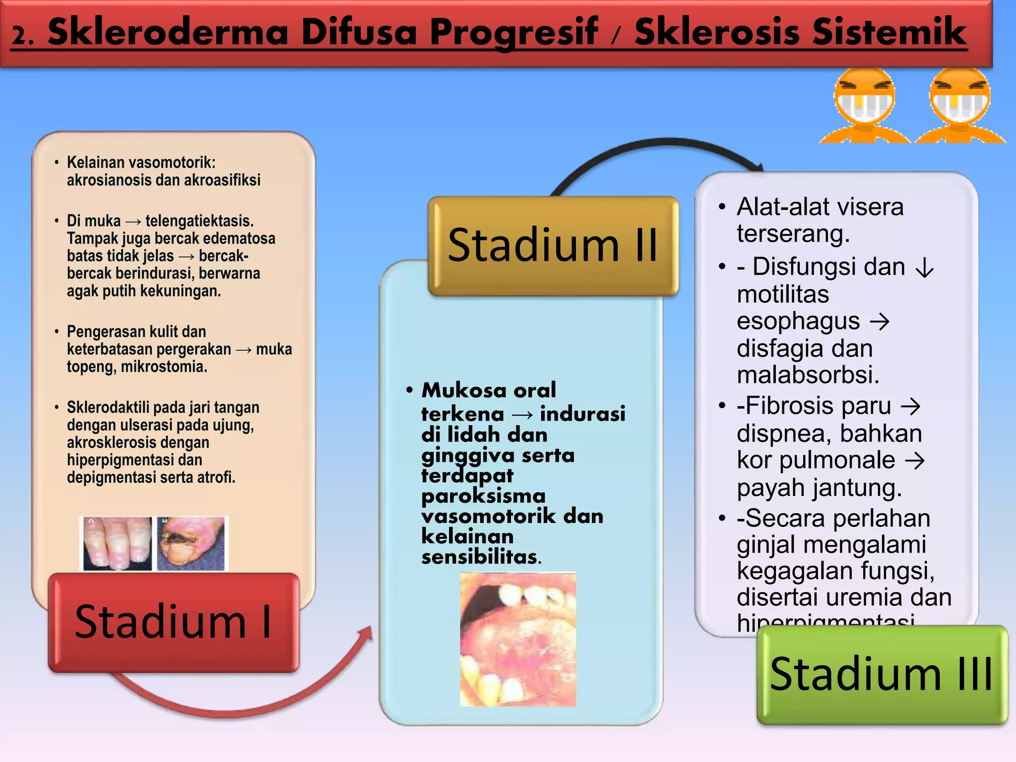 Skleroderma ppt | PPTX