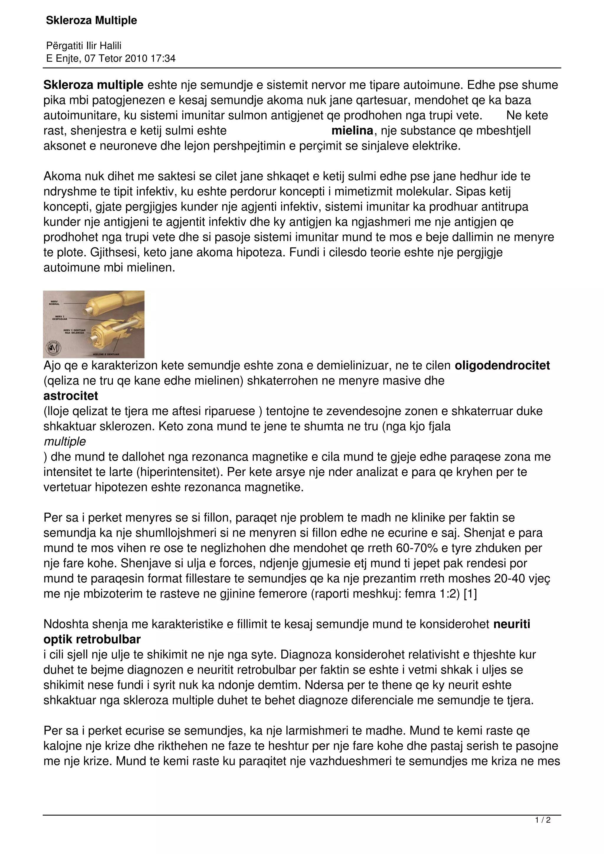 Skleroza multiple | PDF