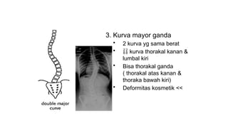 PENATALAKSANAAN FISIOTERAPI PADA SKOLIOSIS.PPT