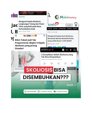 HATI HATI STRUKTUR TULANG BERUBAH BERBAHAYA BUAT ORGAN! | PDF