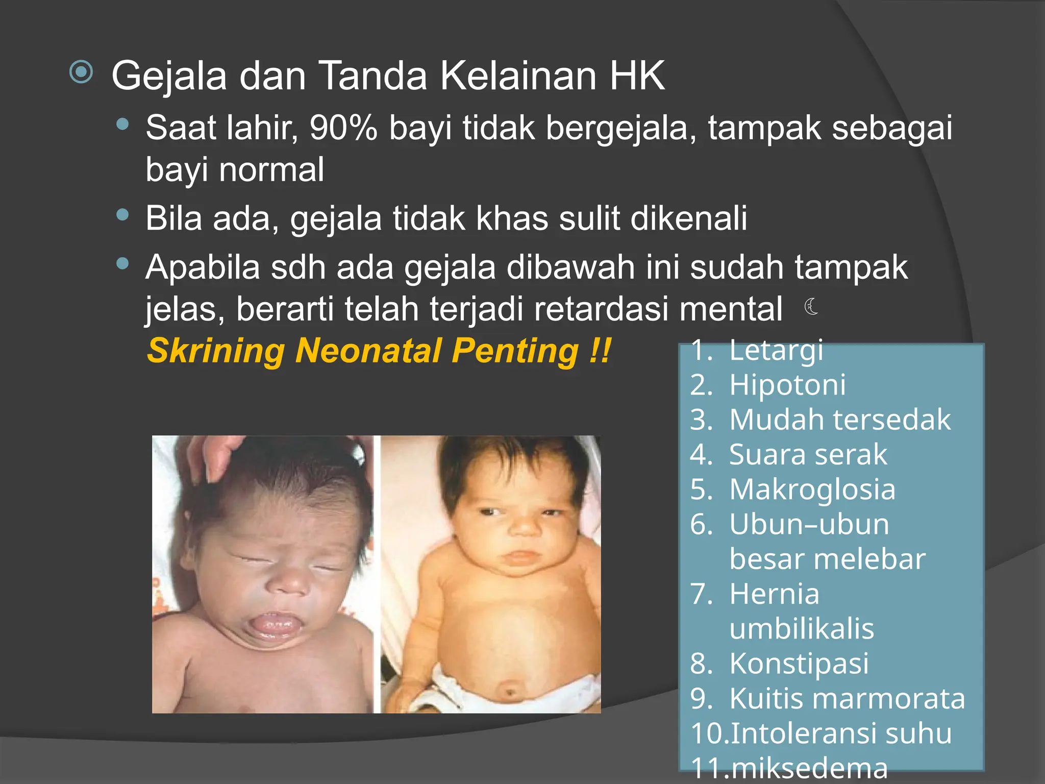 Skrining Hipotiroid Kongenital pada Anak | PPT