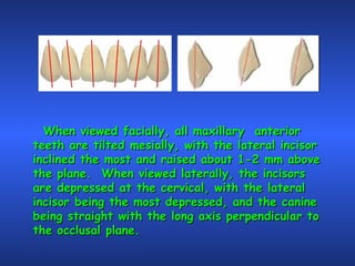 tooth arrangement for preclinical prosthodontics | PPT