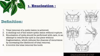 management of dentigerous cyst | PDF