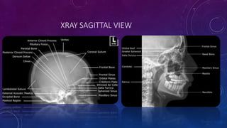 skull-1.pptx