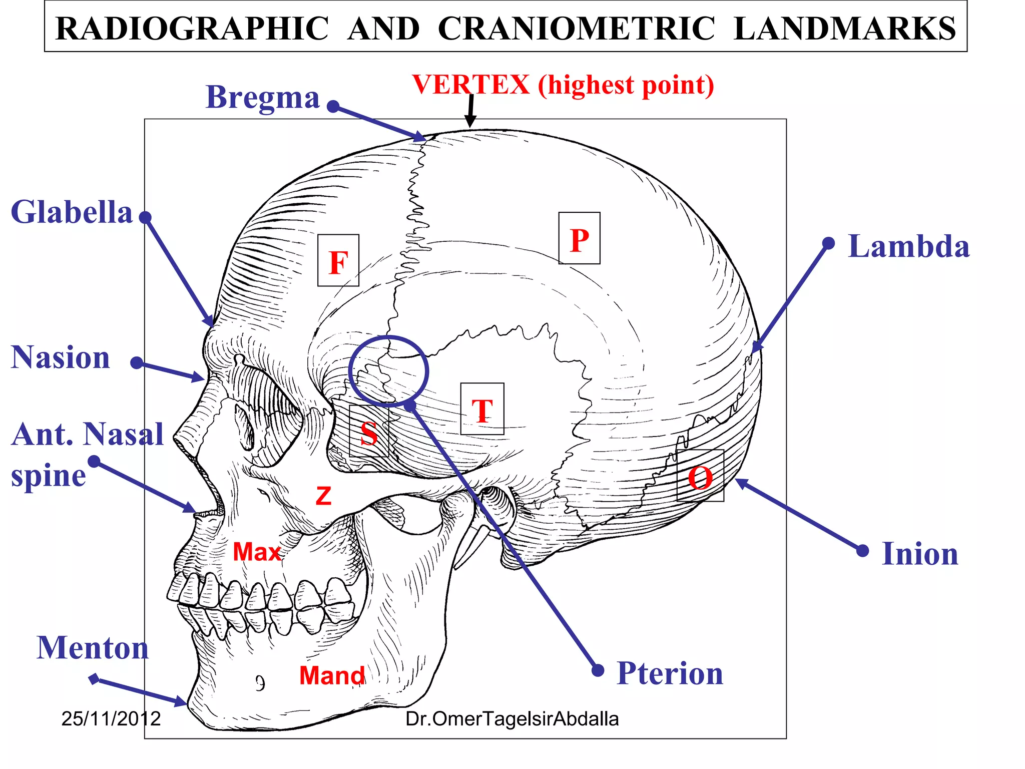 Anatomy of the Skull | PPT