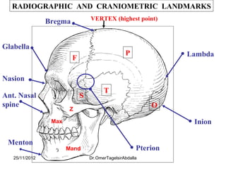 Anatomy of the Skull | PPT