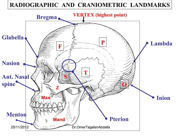 Anatomy of the Skull | PPT | Bone and Joint Conditions | Diseases and ...