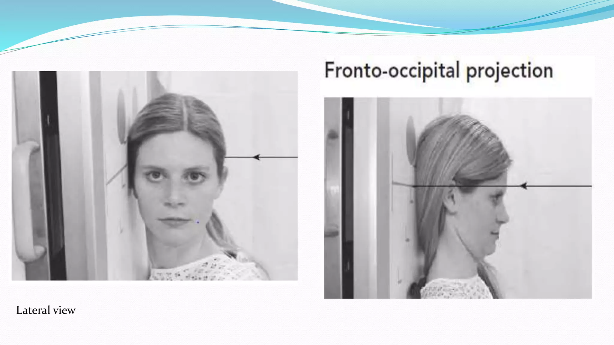 Radiography Anatomy of Skull | PPTX