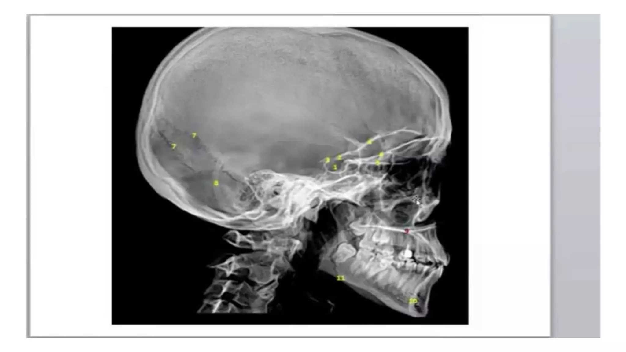 Skull X-Ray | PPTX