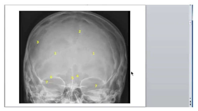 Skull X-Ray | PPTX