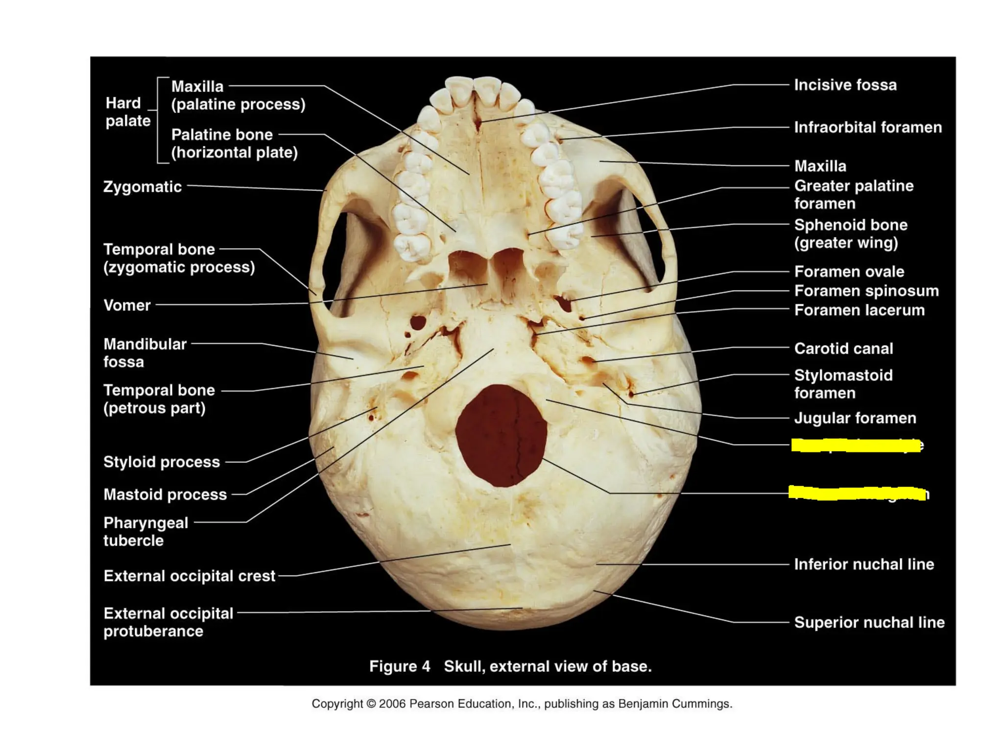 The Anatomy of the Skull power point presentation | PPT