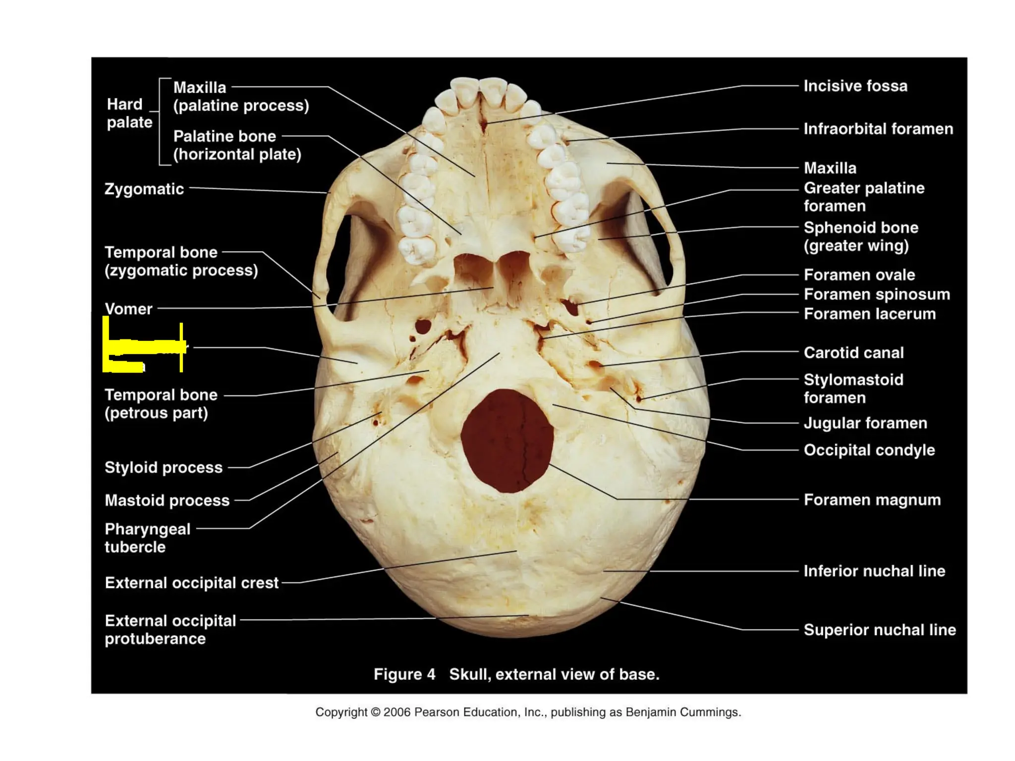 The Anatomy of the Skull power point presentation | PPT