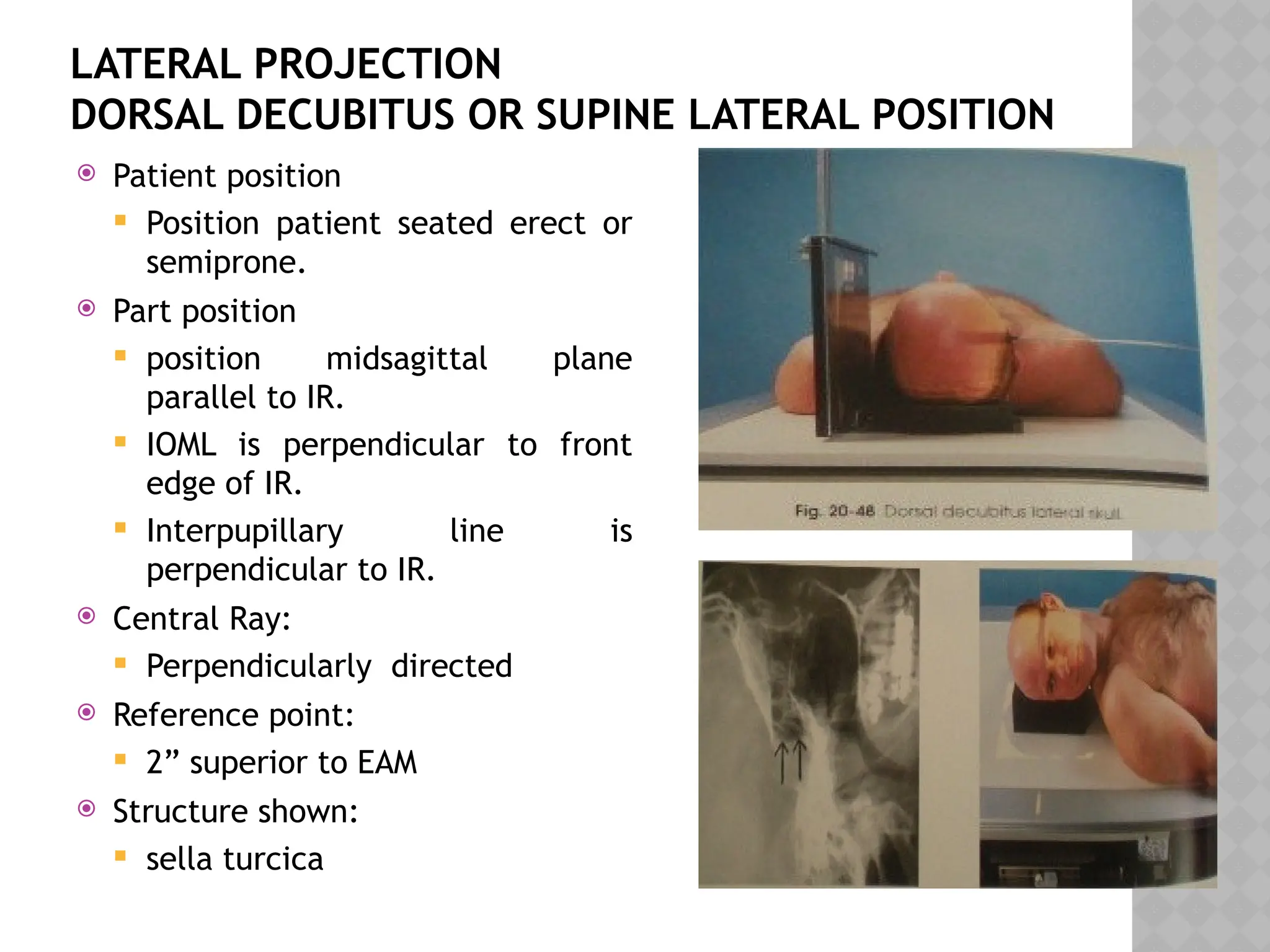 Radiographic positioning II. Skull positioning | PPTX