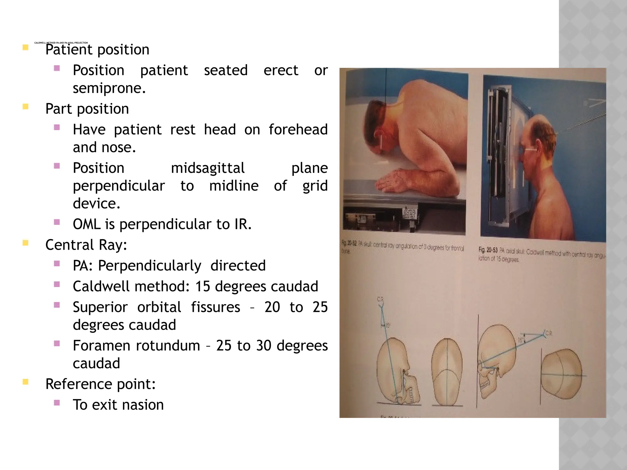 Radiographic positioning II. Skull positioning | PPTX
